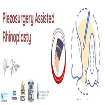 Piezosurgery assisted rhinoplasty minia.pdf