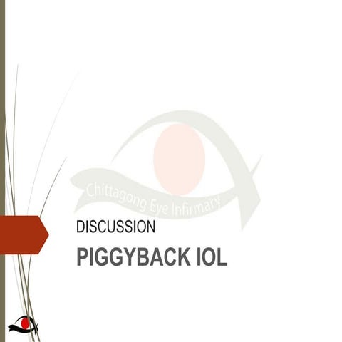 Update on pupil stretching and capsular stabilization devices | PPT