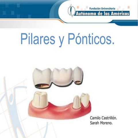 Pilares y ponticos | PPTX