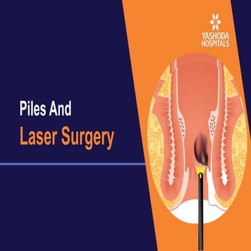 Piles Types, Causes and Symptoms | Piles Laser Treatment in Hyderabad | PPT