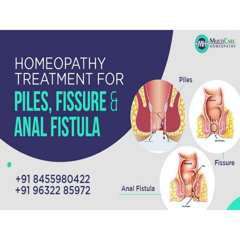 Best homeopathy fissure homeopathy doctor in Bhubaneswar | PPTX | Herbs and Supplements ...