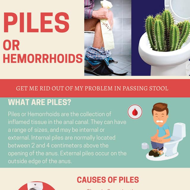 Piles (hemorrhoids ) | PDF