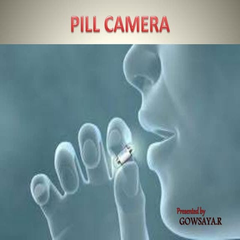 Pill cam 2 | PPTX | Digestive Disorders | Diseases and Conditions