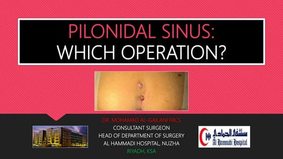 Laparoscopic Repair of Strangulated Spigelian Hernia | PPT