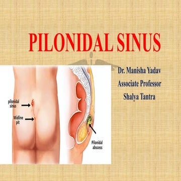 pilonidal sinus.pptxhdhdhdhdhdbdbdbdbfbfb | PPTX
