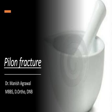 Pilon fracture | PPTX