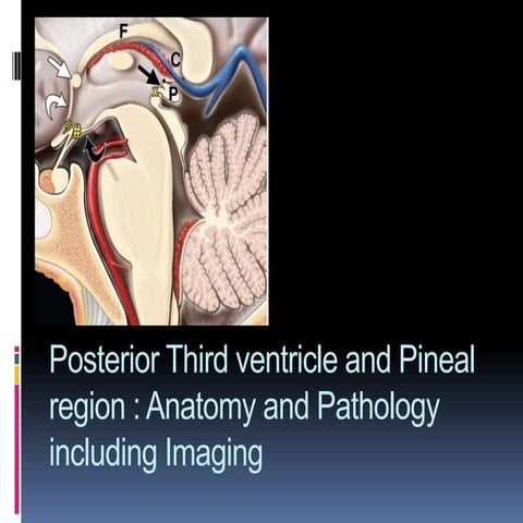 Anatomy of Pineal Gland | PPTX