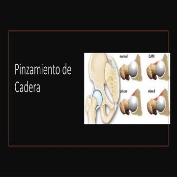 Abducción y aduccion de cadera.ppt completo | PPT