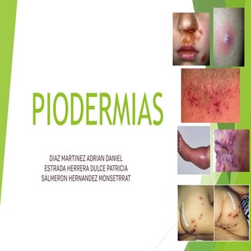 PIODERMIAS.pdf