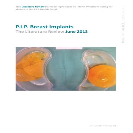 P.I.P. Breast Implants The Literature Review June 2013 | PDF
