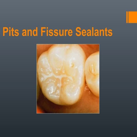 Pit and fissure sealants | PPTX