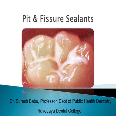 pit and fissure suri.ppt