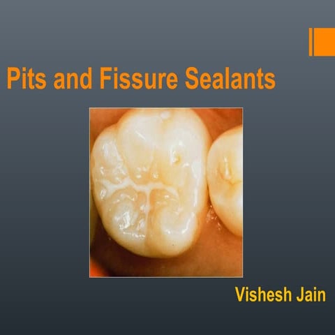 Pit and Fissure Sealant | PPT