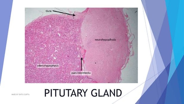 Pituitary Gland Slide Labeled