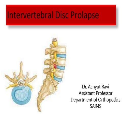 Prolapse Intervertebral Disc LECTURE.pdf | Death, Injury, or Military ...