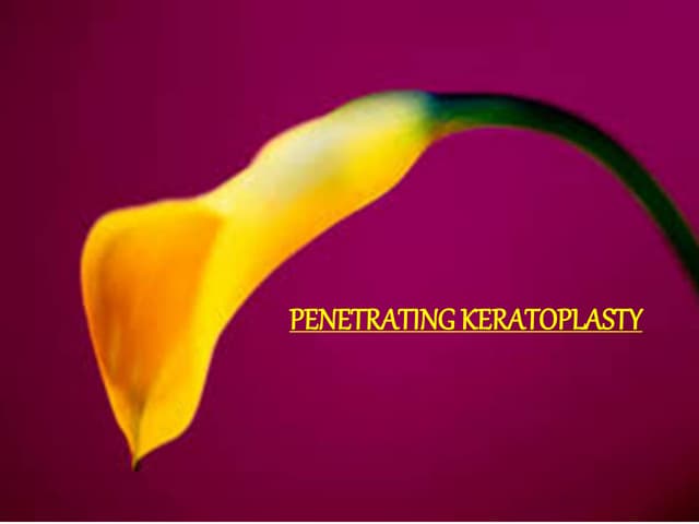 Keratoplasty | PPTX