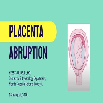 Placenta abruption | PPTX