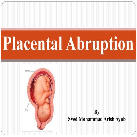 Placenta Abruption.pptx