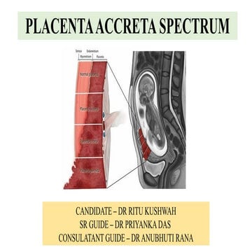 Placenta accreta spectrum dreadly complicationpptx | PPTX