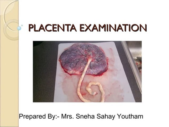 EXAMINATION OF THE PLACENTA.pptx