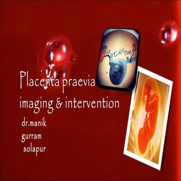 Placenta praevia | PPT