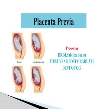 PLACENTA PREVIA -Antepartum hemorrhage.pptx
