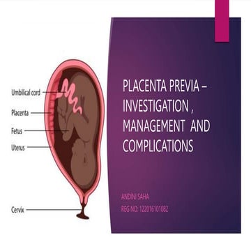 PLACENTA PREVIA REMASTERED Presentation[1].pptx