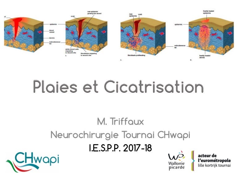Cicatrisation Plaie Profonde – Comment Cicatriser Les Plaies Rapidement ...