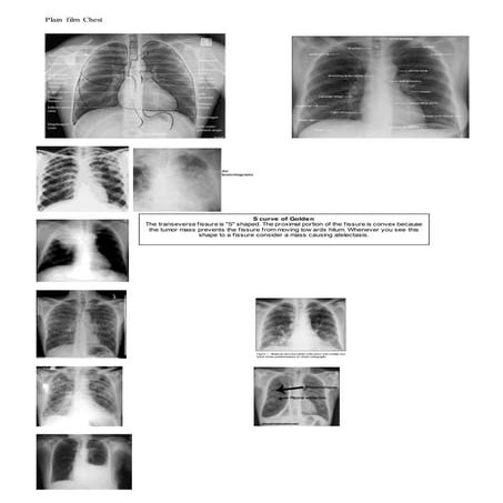 Plain film chest | DOCX