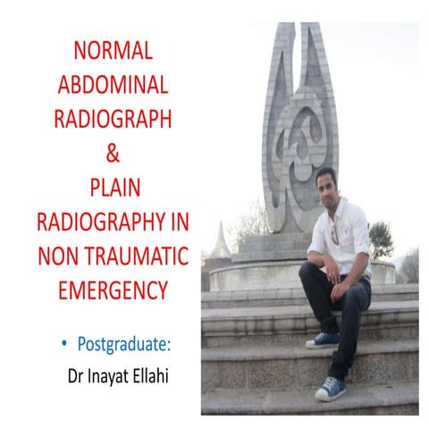 Plain radiography in acute abdomen | PPTX