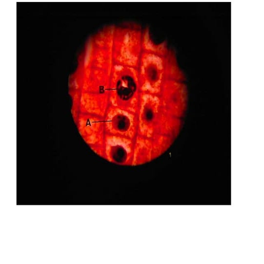 Plant & Animal Cell Mitosis Microviewer Pictures | PPTX
