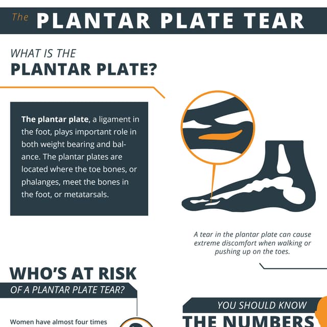 Infographic | The Plantar Plate Tear | PDF