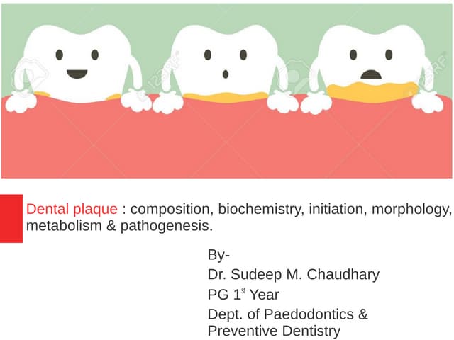 Dental plaque.ppt