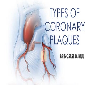 TYPES OF CORONARY PLAQUES SLIDESHARE PRESENTATION | PDF