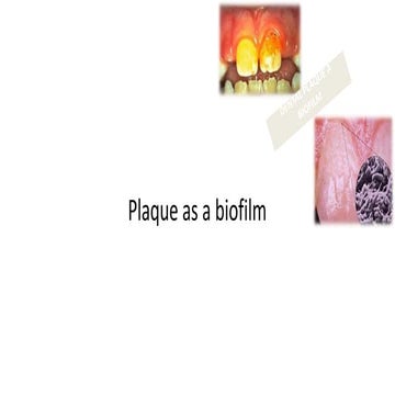 plaque as a biofilm power point in periodontics | PPTX