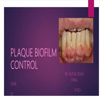 PLAQUE BIOFILM CONTROL.pptx