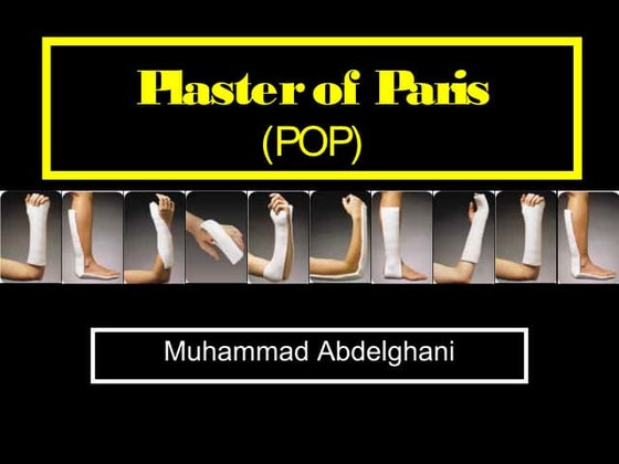 Plaster of Paris | PPT