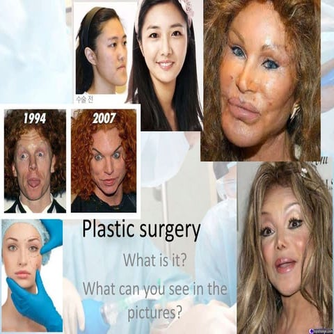 Views On Plastic Surgery | Why breast implant removal surgery is on the ...