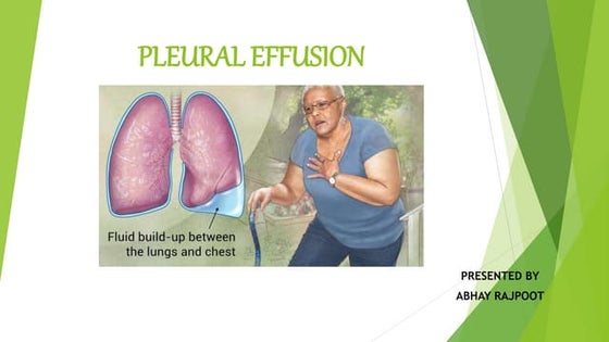 Pleural effusion | PPT