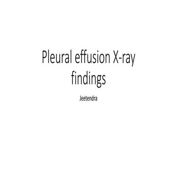 Pleural effusion(X-ray Findings) | PDF