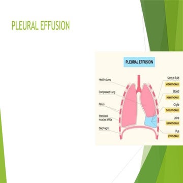 Non Malignant Pleural effusions and TB effusion.pptx