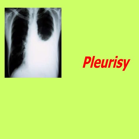 Pleurisy.ppt