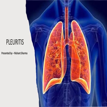 PLEURITIS . | PPT