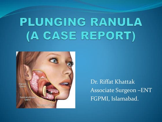 radiology of Maxillary sinus | PPT