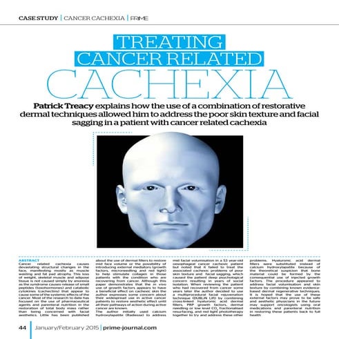 Treating face wasting secondary to cancer related cachexia | PDF