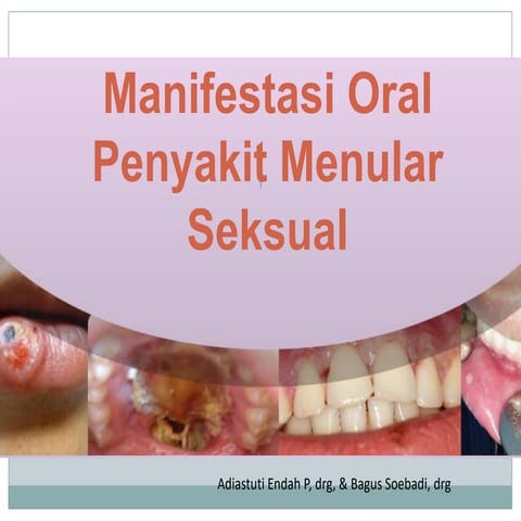 PMS ORAL.pptx