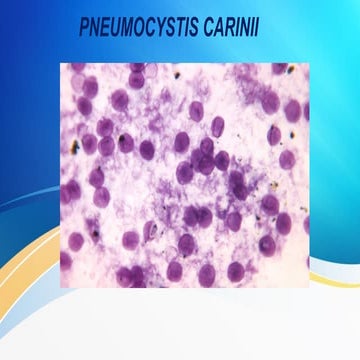 Pneumocystis carinii.pptx Clinical microbiologist | PPTX