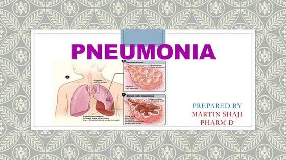 Bronchitis | PPT