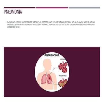PNEUMONIA-types and classification .pptx