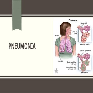 PNEUMONIA AND ITS MANAGEMENT WITH TREATMENT.pptx